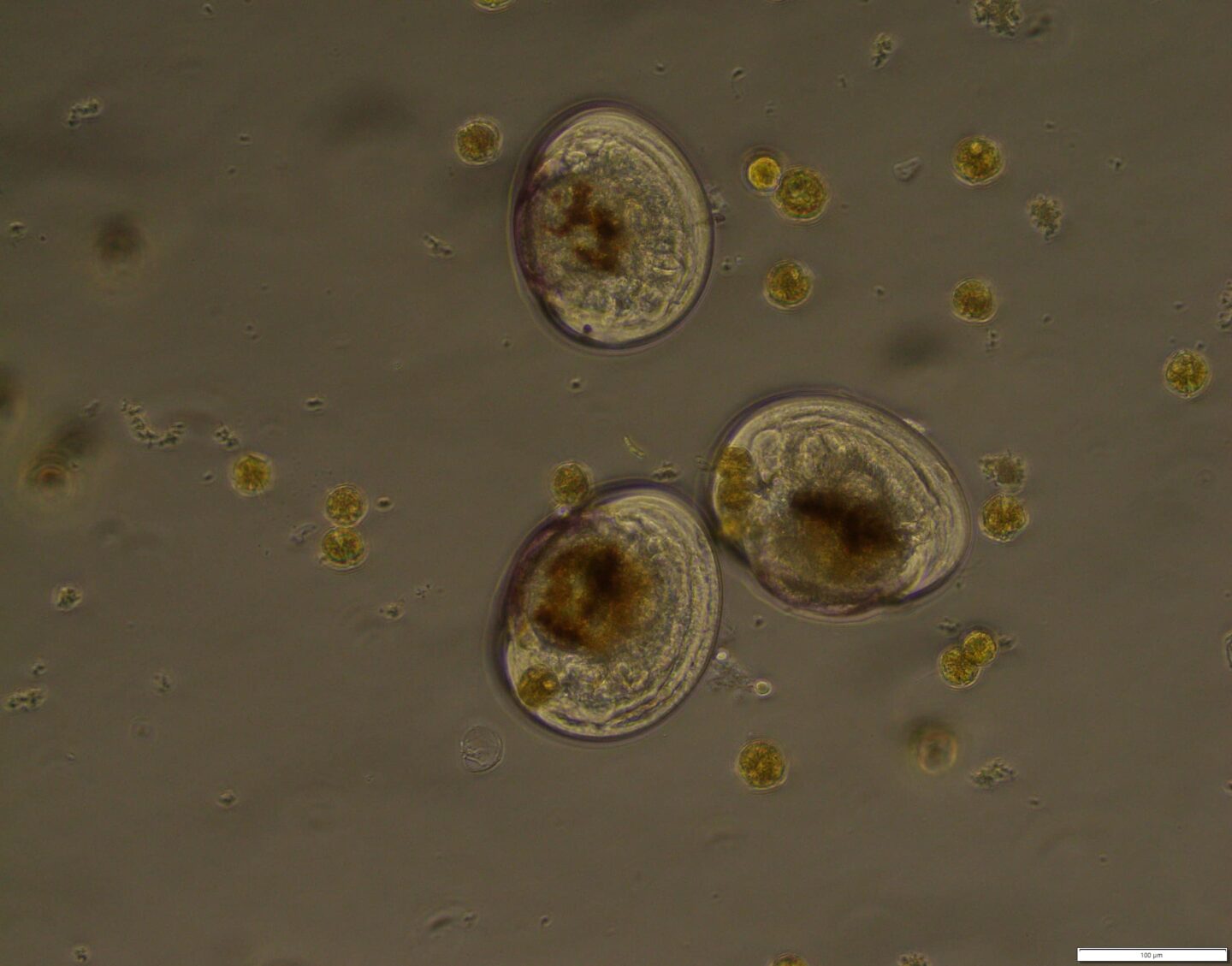 Harmful Algal blooms and Shellfish, a case study