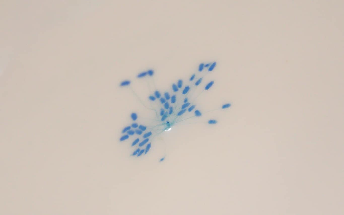 Harmful Algal blooms and Shellfish, a case study